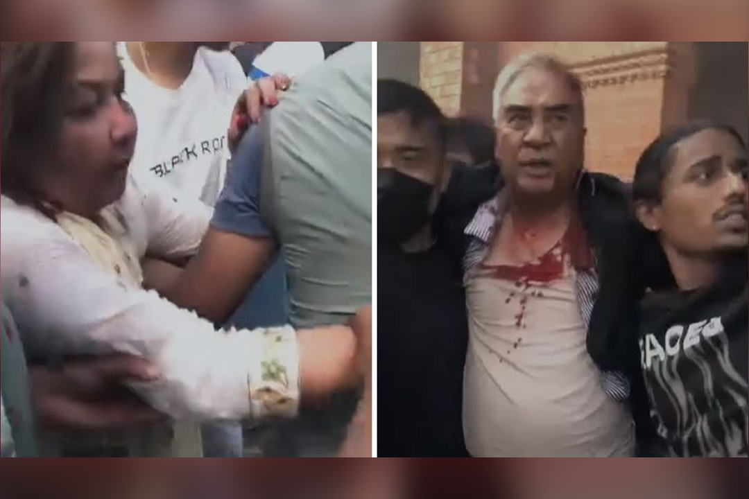 Protests Injure Deuba and Cash Dividend Announcement by NIFRA | News ...